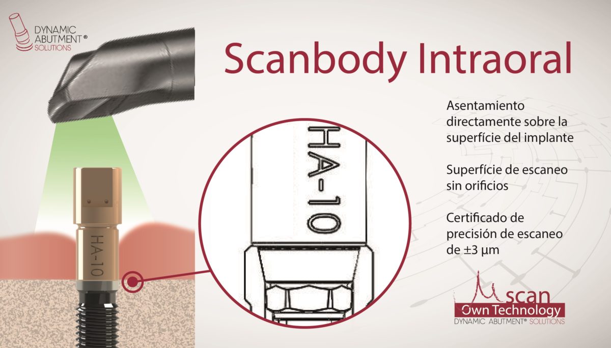 EL SISTEMA SCANBODY INTRAORAL MÁS PRECISO - Dynamic Abutment Solutions ES