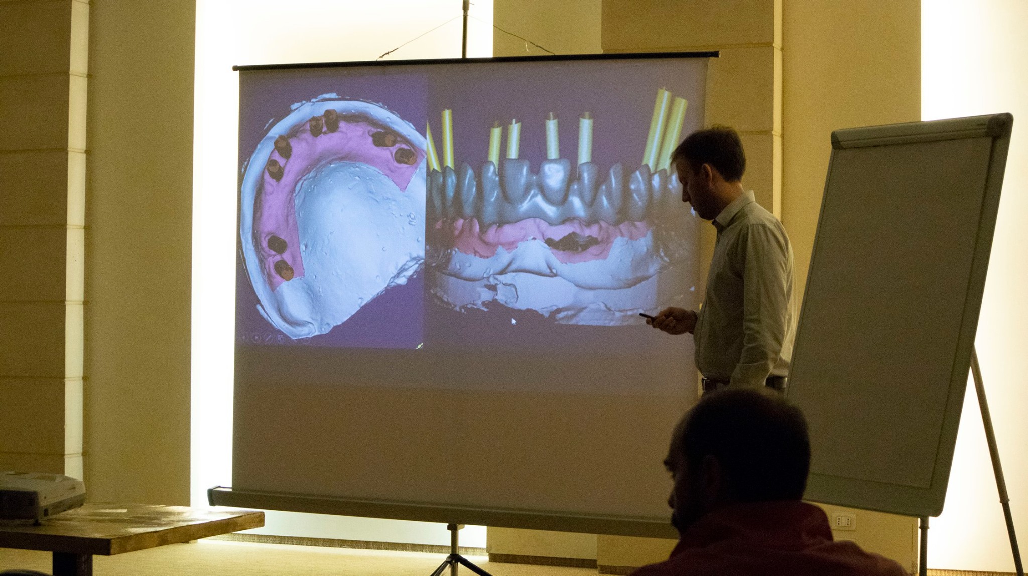 TRAINNING DAS CON SUM3D - Dynamic Abutment Solutions ES