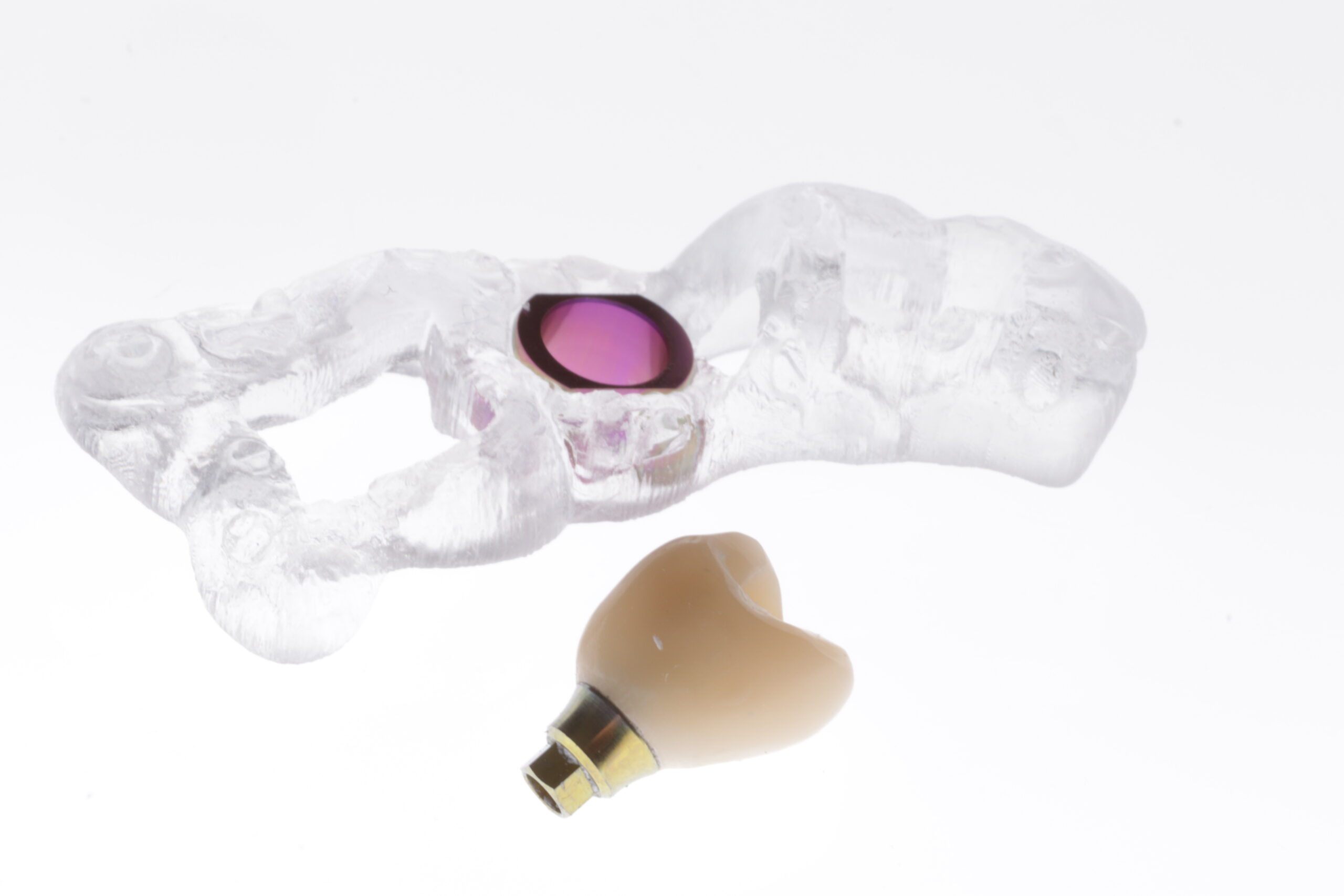 CASO: Kit de Cirugía Guiada DAS - Dynamic Abutment Solutions ES