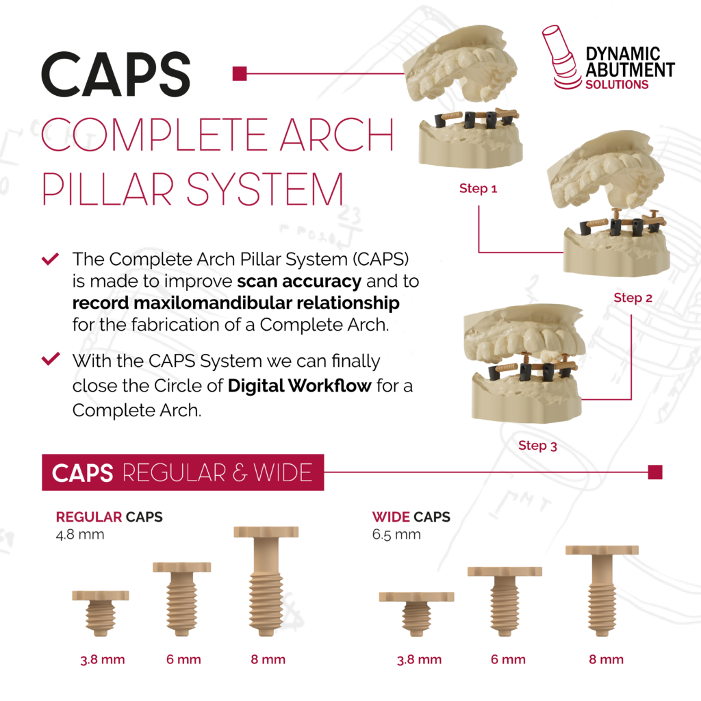 CAPS Complete Arch Pillar System - Dynamic Abutment Solutions ES